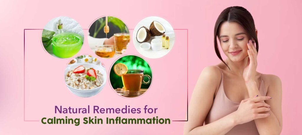 9 Natural Remedies For Calming Skin Inflammation And Itching